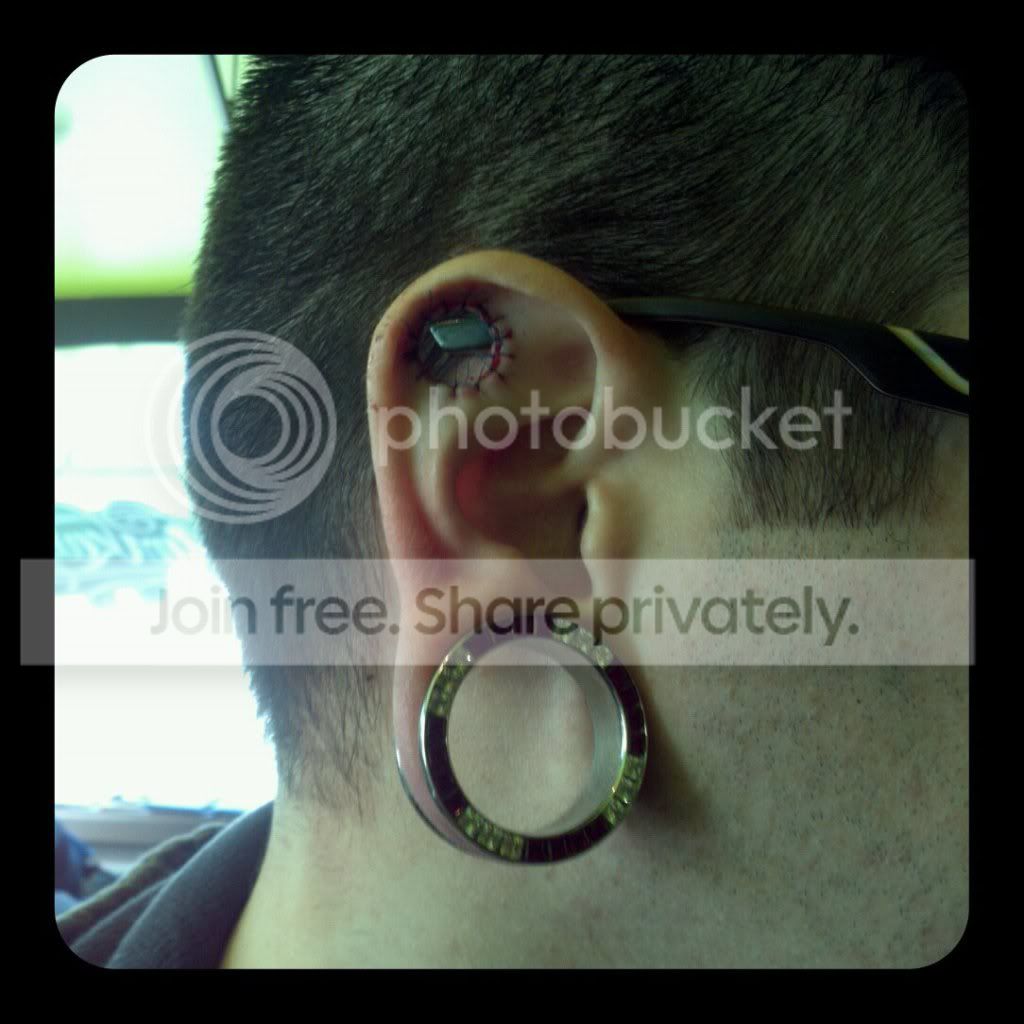 Experiences with a conch dermal punch? : r/piercing